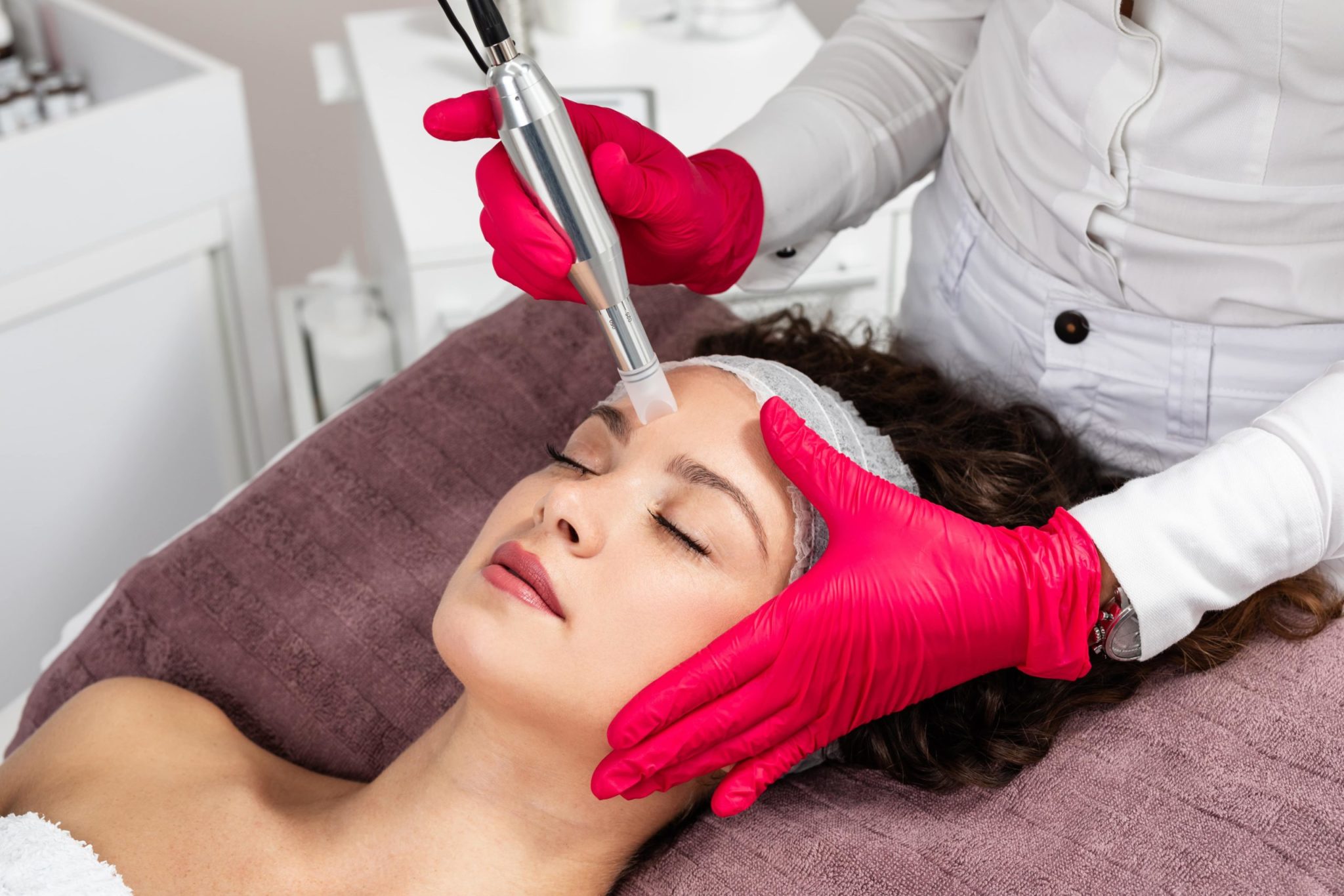 Top 5 Benefits Of MAD Exceed Microneedling